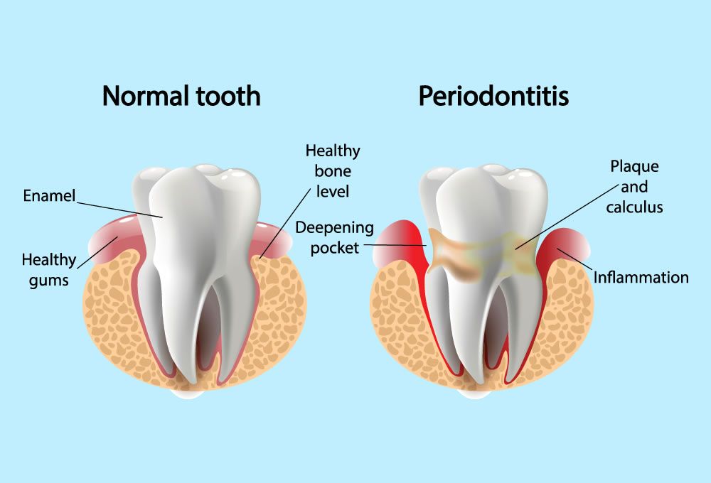 Texas Dental Arts Services - North Fort Worth / Keller, Texas